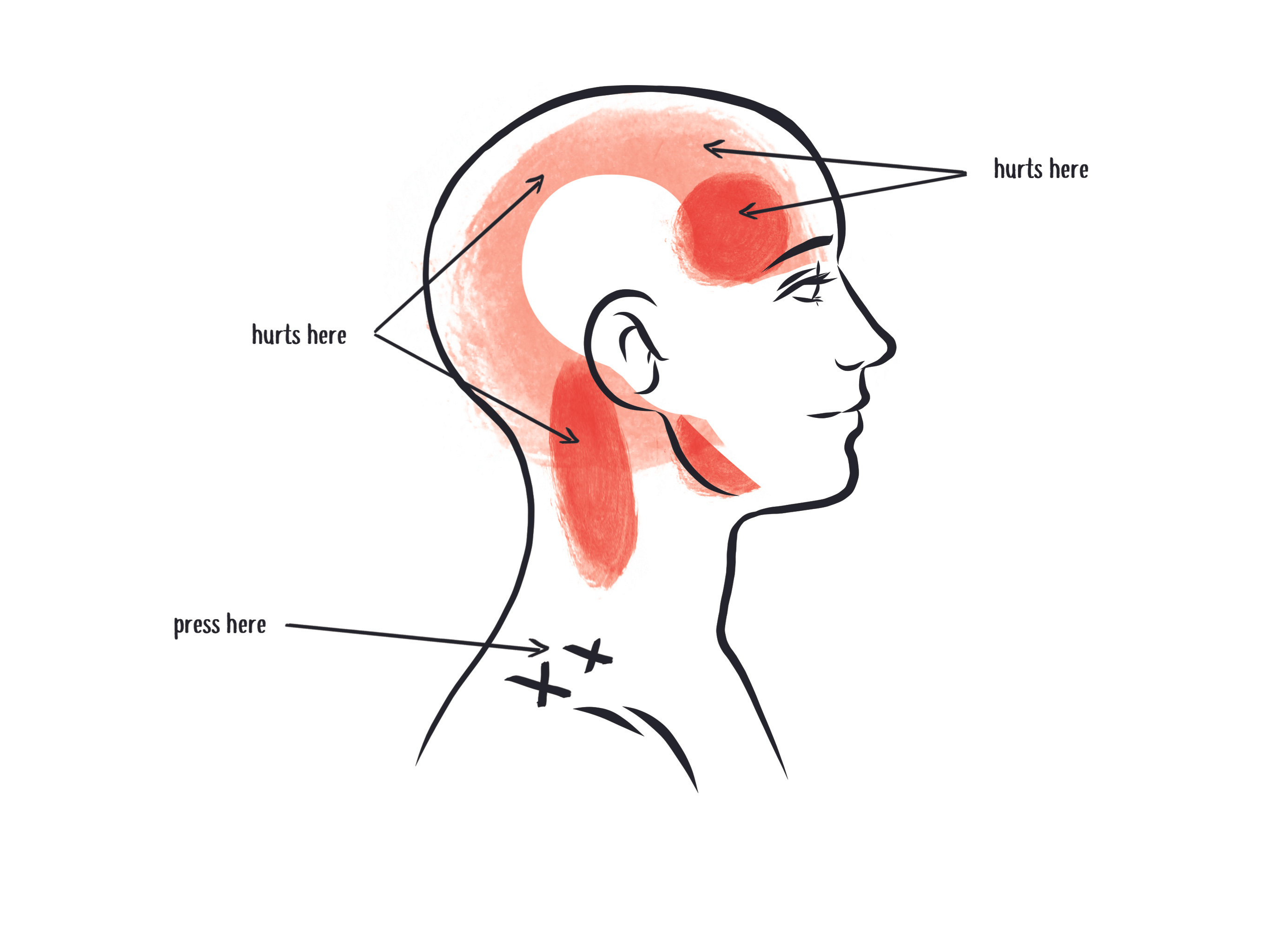 Pain in back of head left side store